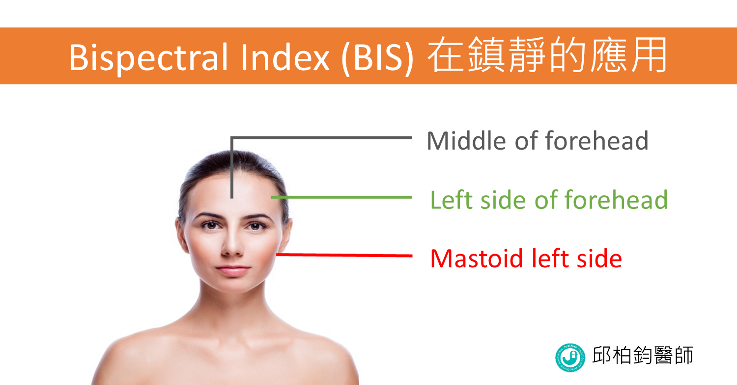邱柏鈞醫師: BIS (Bispectral Index) 原理與鎮靜的應用