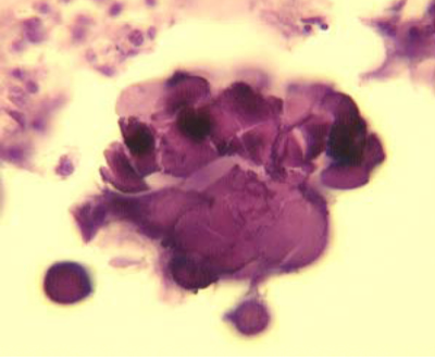 Histology Doodles: Brain Sand. H&E