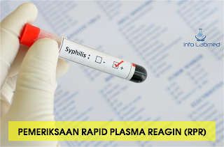 RPR (Rapid Plasma Reagin) | Penjelasan dan Identifikasi