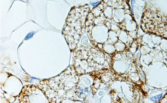 Terra Forming Terra: White - Brown Fat Conversion Understood