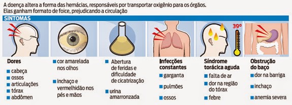-: Sinais e Sintomas - Anemia Falciforme