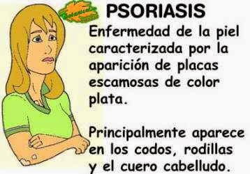 Psoriasis Cura: ᐅ Psoriasis Qué Es: Causas, Síntomas y Tratamientos ...