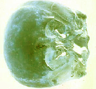 La Ciencia Baila con Dios.: el “Starchild Skull”; eL Cráneo del niño de ...