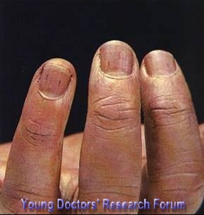 Some Important Findings in General Physical Examination (GPE) ~ YOUNG ...