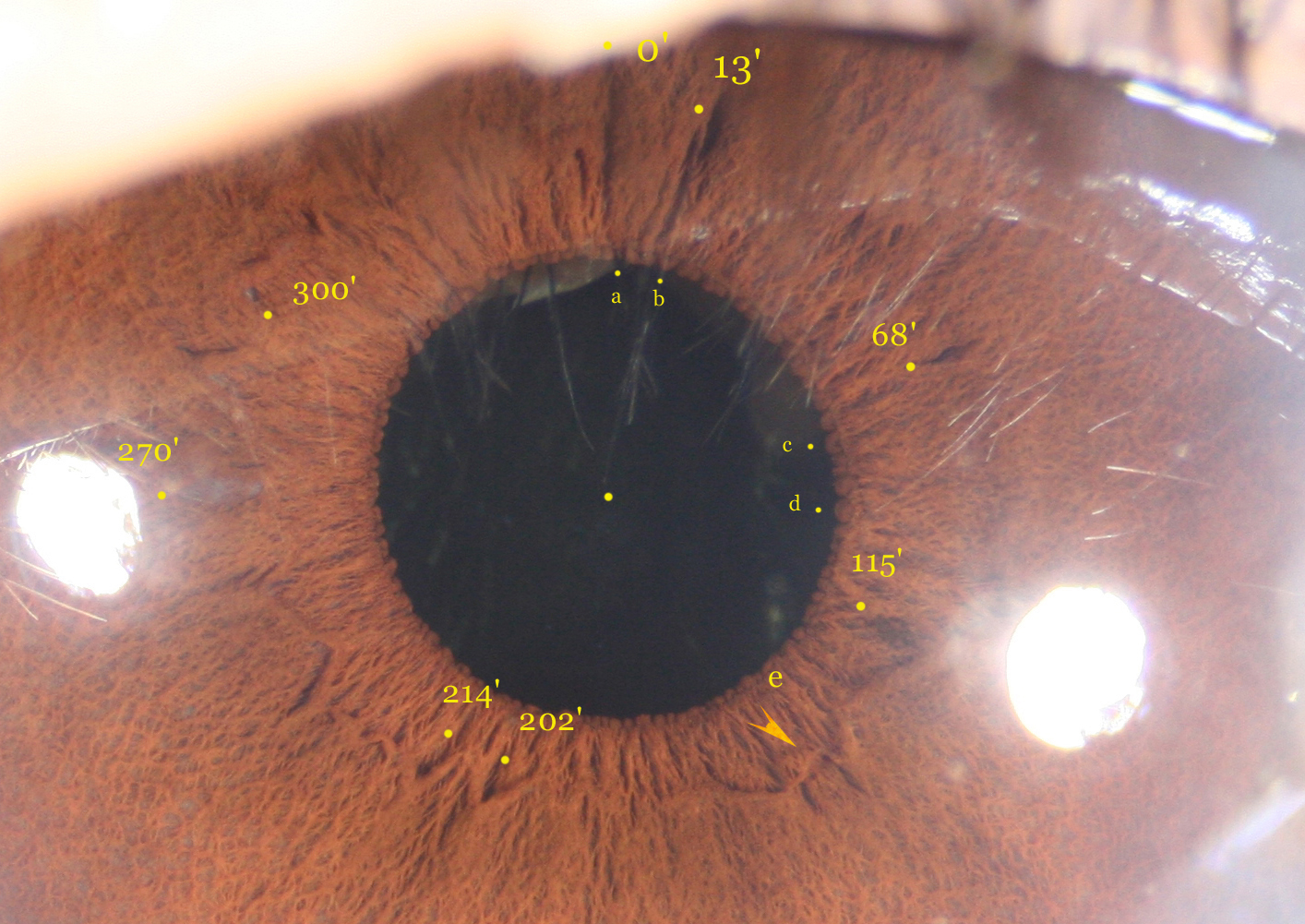 Modern & Multidimensional Iridology: Classical, Modern ...
