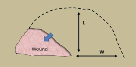 Curso de Cirugía Plástica CiruplasMedia: Colgajos