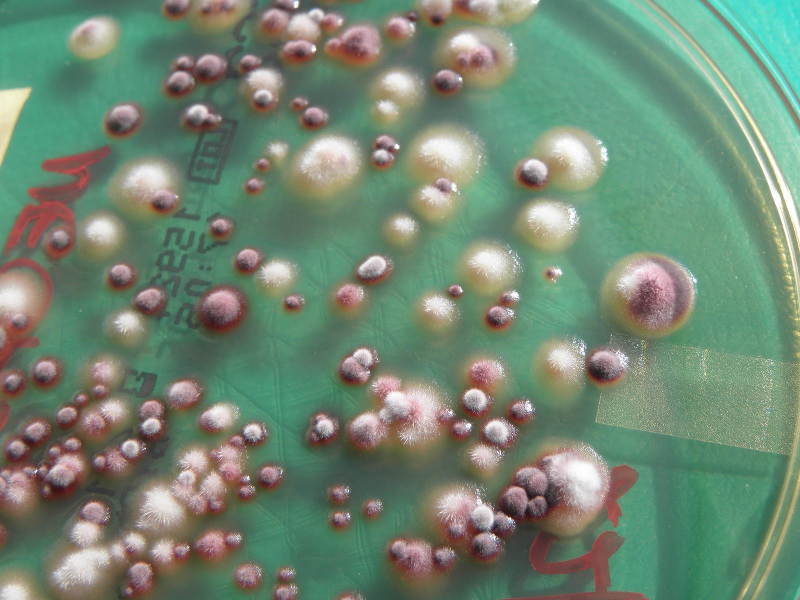 ATLAS MICOLOGIA: TRICHOPHYTON VIOLACEUM