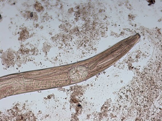 Fun With Microbiology (What's Buggin' You?): Enterobius vermicularis ...