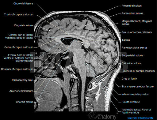 Magnetic Resonance Imaging Of Brain Mri Brain 0 Hot Sex Picture
