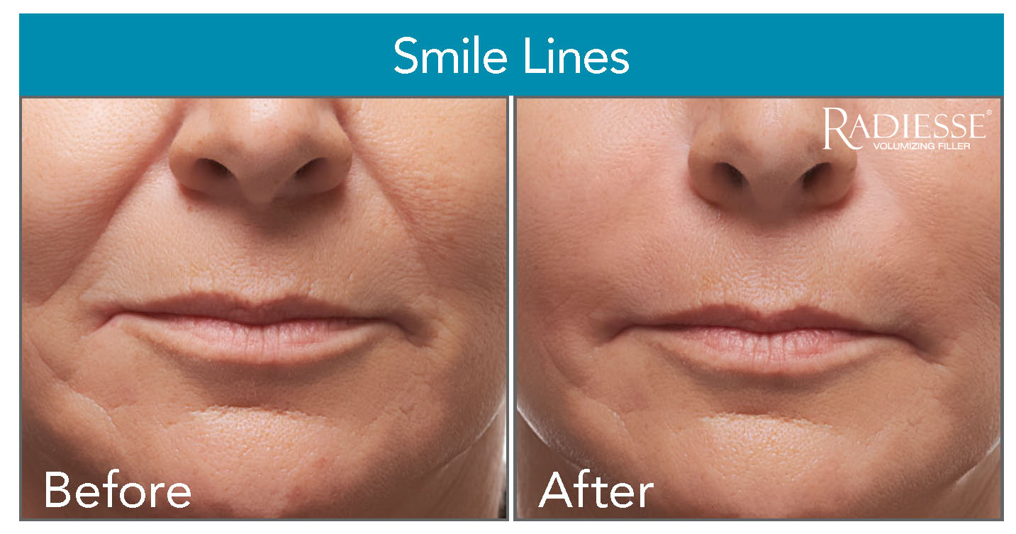 everydayliving®: March 2012