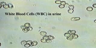 MICROSCOPIC URINALYSIS