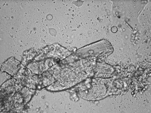 [Microbiology] Atlas of Fecal Analysis | Free Medical Atlas