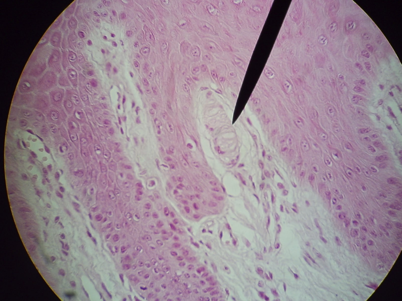 MEDICINA USMP: FOTOS DE HISTO SISTEMA NERVIOSO