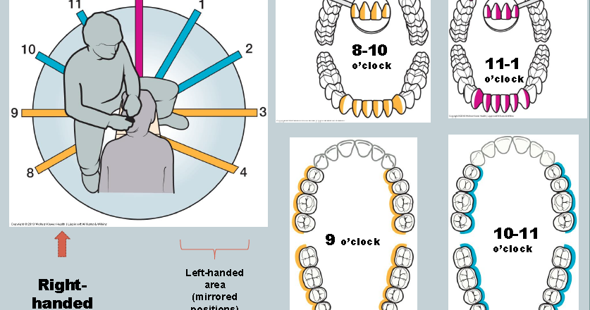 Periodontal Instruments: Concepts in periodontal scaling and how tos