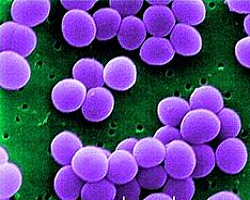 all about Staphylococcus ~ dreamer