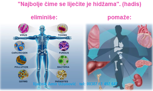 Hidžama Bosna i Hercegovina: Hidzama, cupping therapy, Bosna i ...