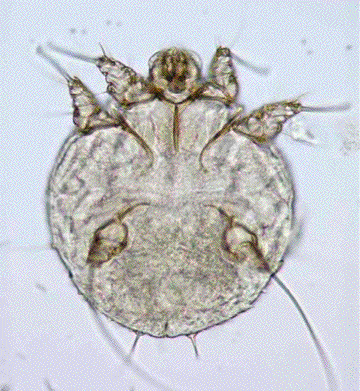 Scabies : Etiology, Mode of transmission, Clinical features, Diagnosis ...