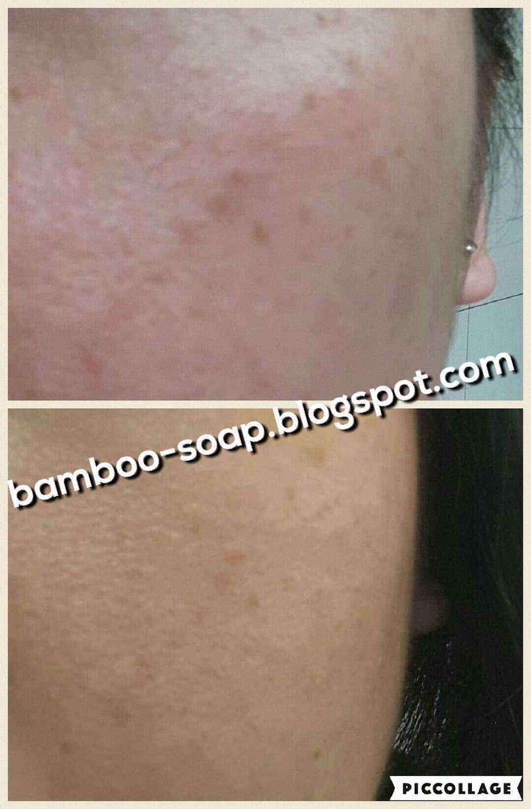 Best Blend For Sensitive Skin Since 2009: Dark Spot Fading Testimonial Pic