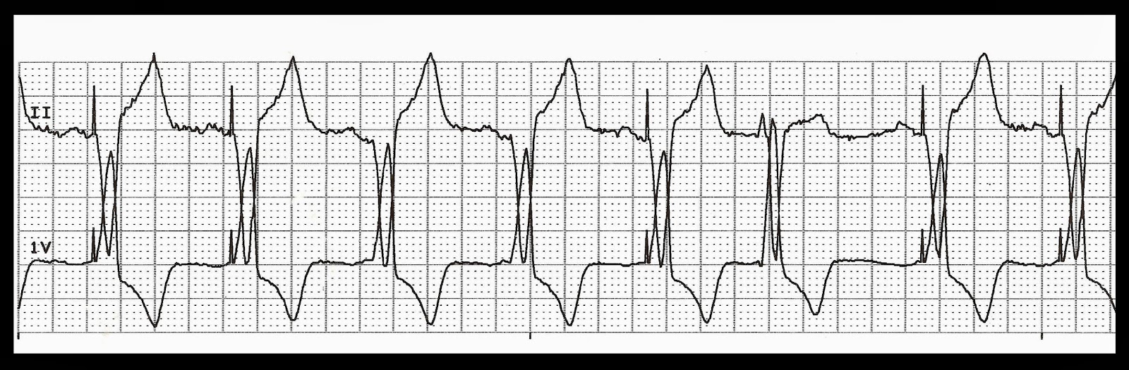 EKG Rhythm Quiz 256