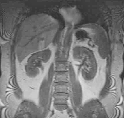 Radiología Musculo-Esqueletica: RMN de cuerpo (tórax, abdomen, pelvis)