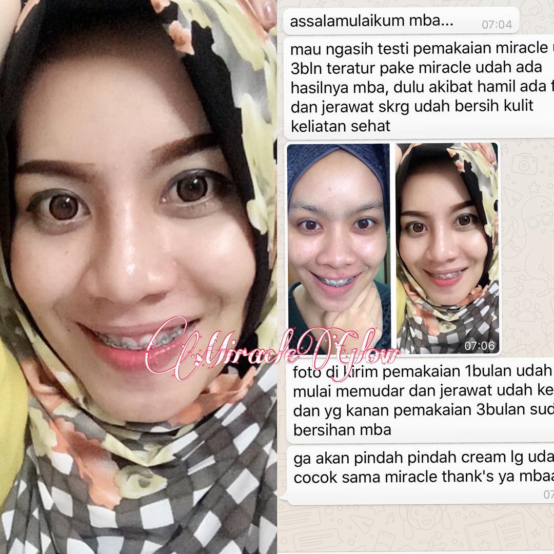 miracle glow platinum: MIRACLE GLOW CREAM PLATINUM