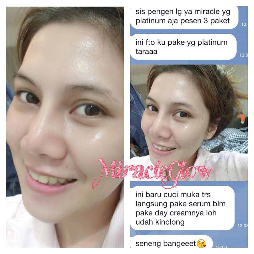 miracle glow platinum: MIRACLE GLOW CREAM PLATINUM