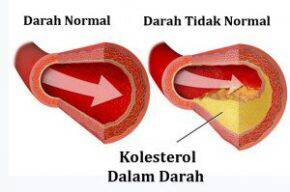 AL Fashdu ~ BEKAM BINTAN THERAPY