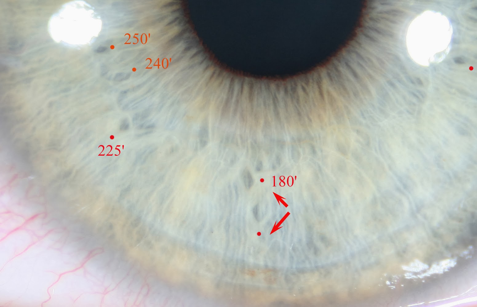 Modern & Multidimensional Iridology: Multidimensional Iridology on ...
