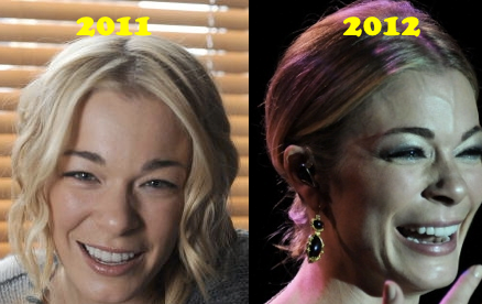 LeAnn Rimes Plastic Surgery