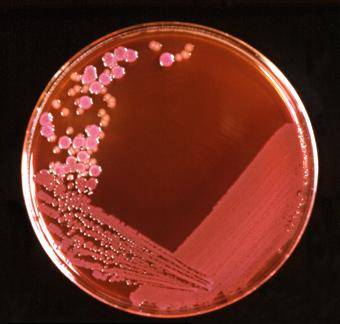 BACTERIOLOGIA: E. coli