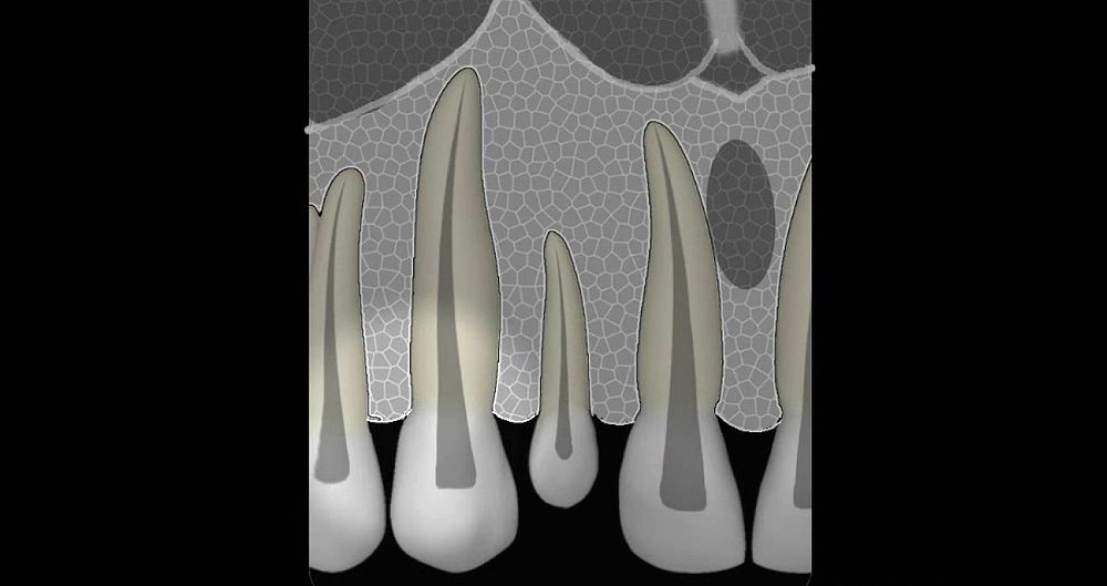 PATOLOGÍA : Alteración de Tamaño en las piezas dentales - Directorio ...