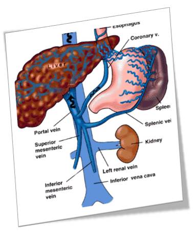 Medical Nursing: SIROSIS HEPATIS