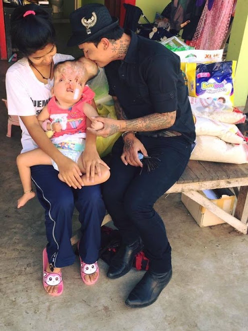 Family seek for help for their 3-year-old severely deformed daughter ...