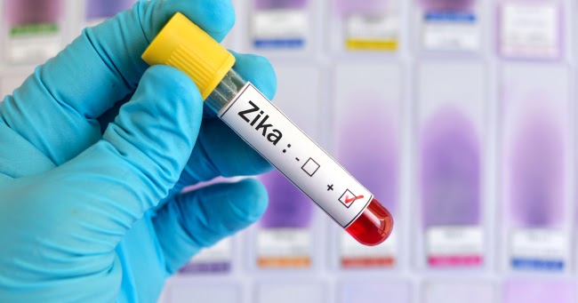 Medical Laboratory and Biomedical Science: CDC: Sexual Transmission of Zika Possible Without ...