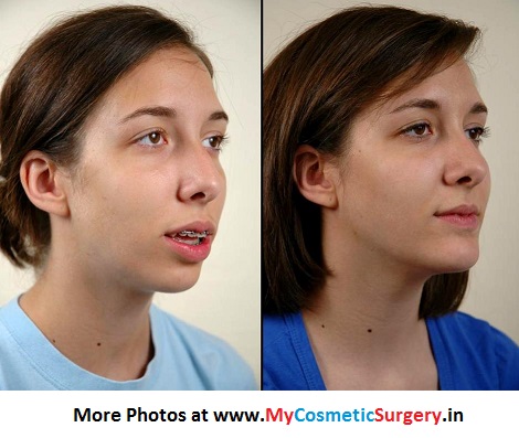 Dr. R.K. Mishra - Plastic & Cosmetic Surgery (SIPS Hospital): Enhance ...