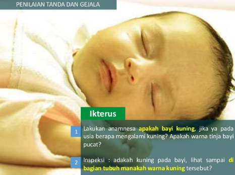 GAMBARAN PENGETAHUAN IBU TENTANG OBSTIPASI PADA BAYI USIA 0-6 BULAN ...