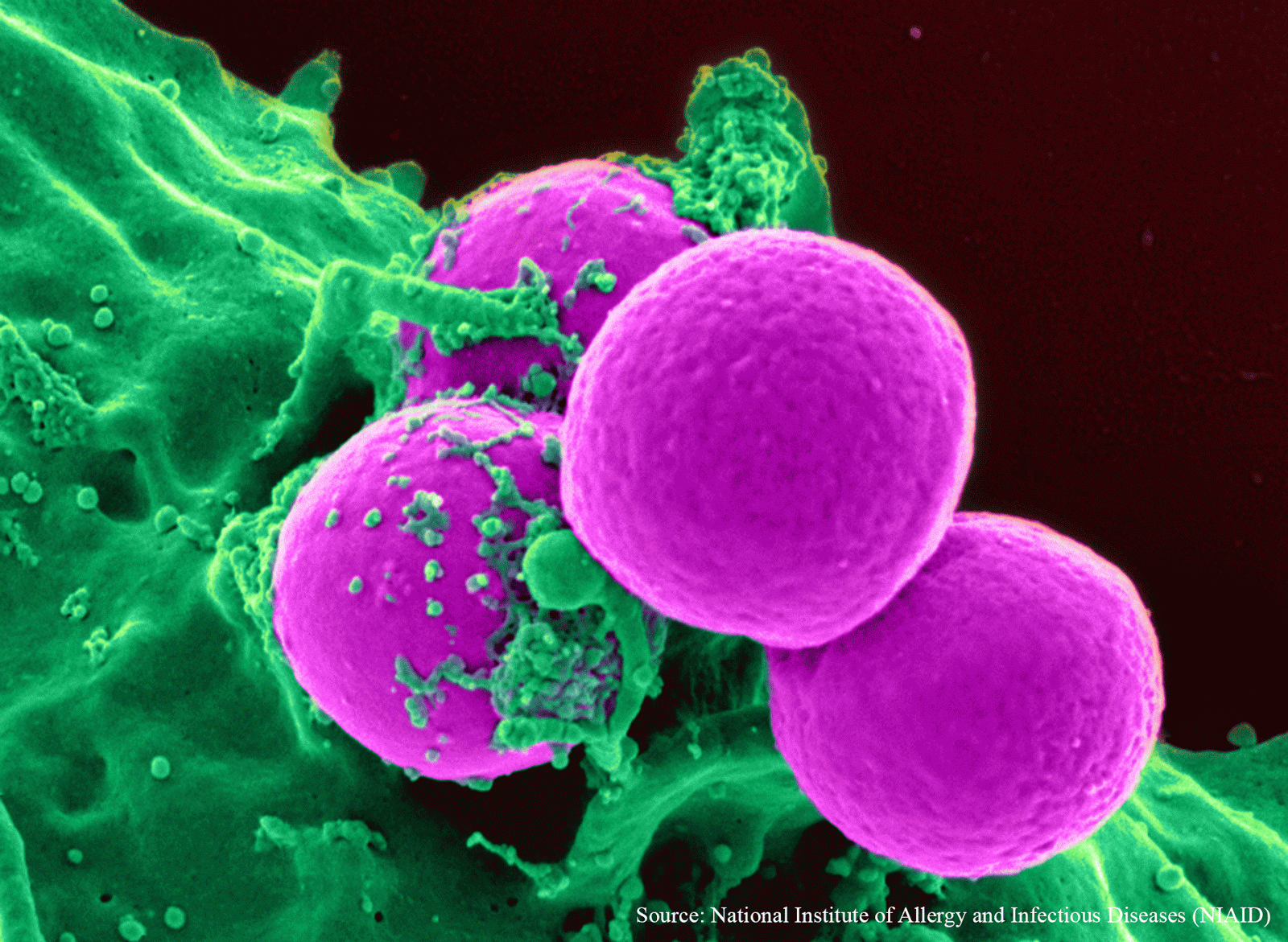 New Strategies Released To Combat Mrsa In Hospitals ~ Infection Control Consulting Services Blog