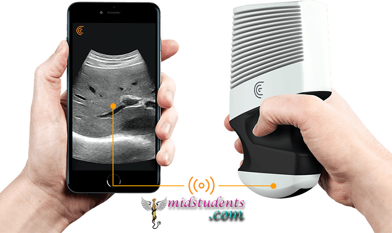 NEW : Wireless, Smartphone Ultrasound Scanner a Safe Alternative to X ...