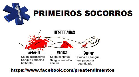 Bombeiros Civis de Santa Cruz do Capibaribe ABCAPE: Tipos de ...