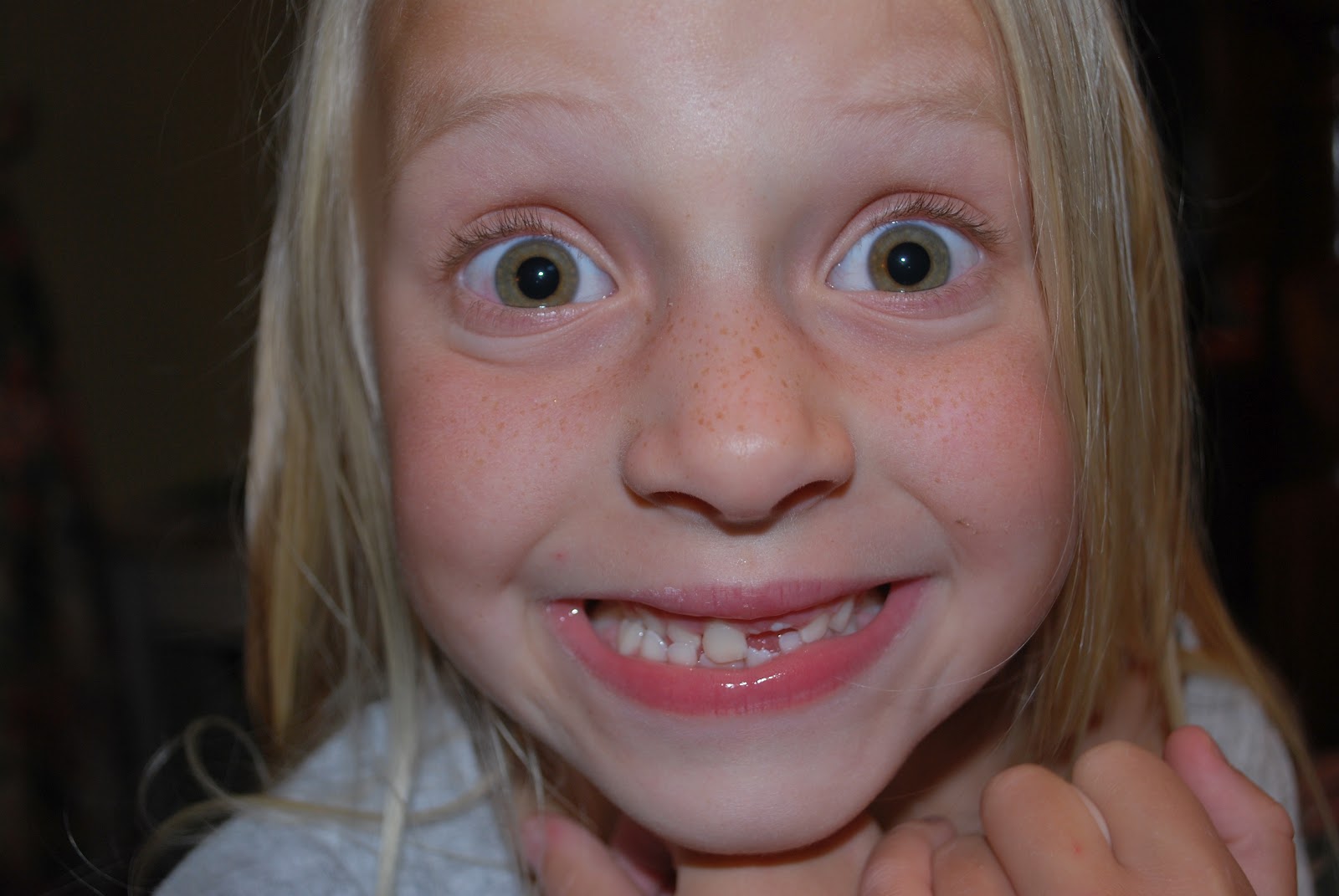 The Warrens: Snaggletooth