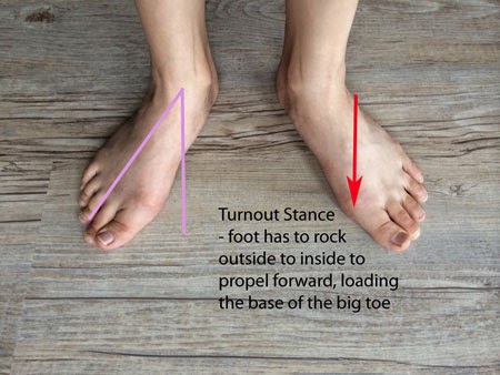 Pelvic Health and Alignment : Healthy Feet, Healthy Pelvic Floor