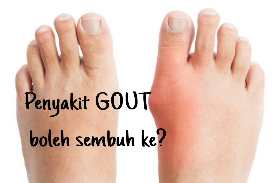 VITAMIN KU SIHAT: September 2018