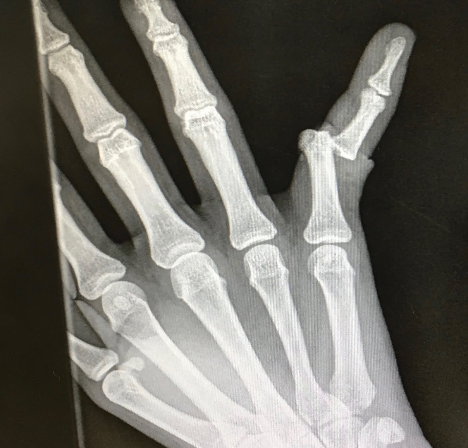 Facing the mess as me | Attachment and Trauma Network