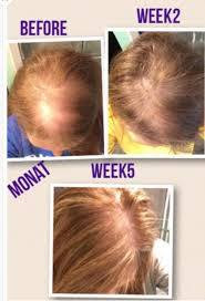 MONAT Global Revolutionary Hair Care Products: Is your hair thinning or ...