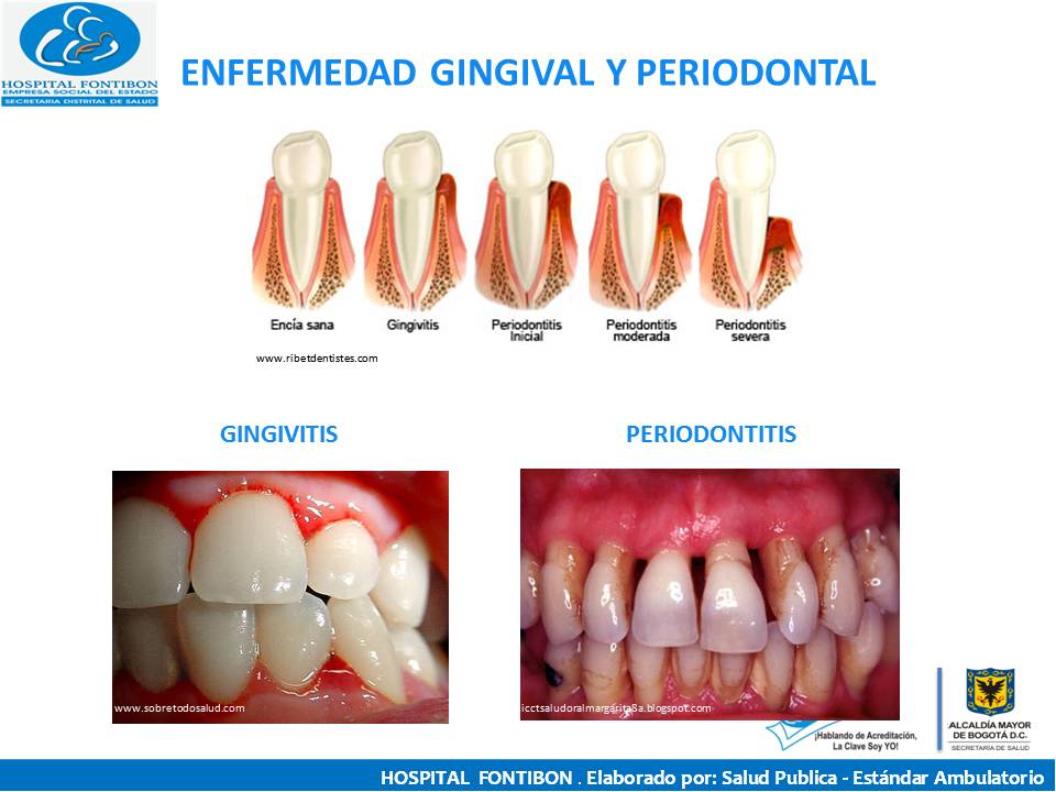 Ambito IPS: ROTAFOLIO DE SALUD ORAL