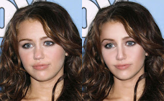 Miley cyrus plastic surgery before and after | World Celebrity