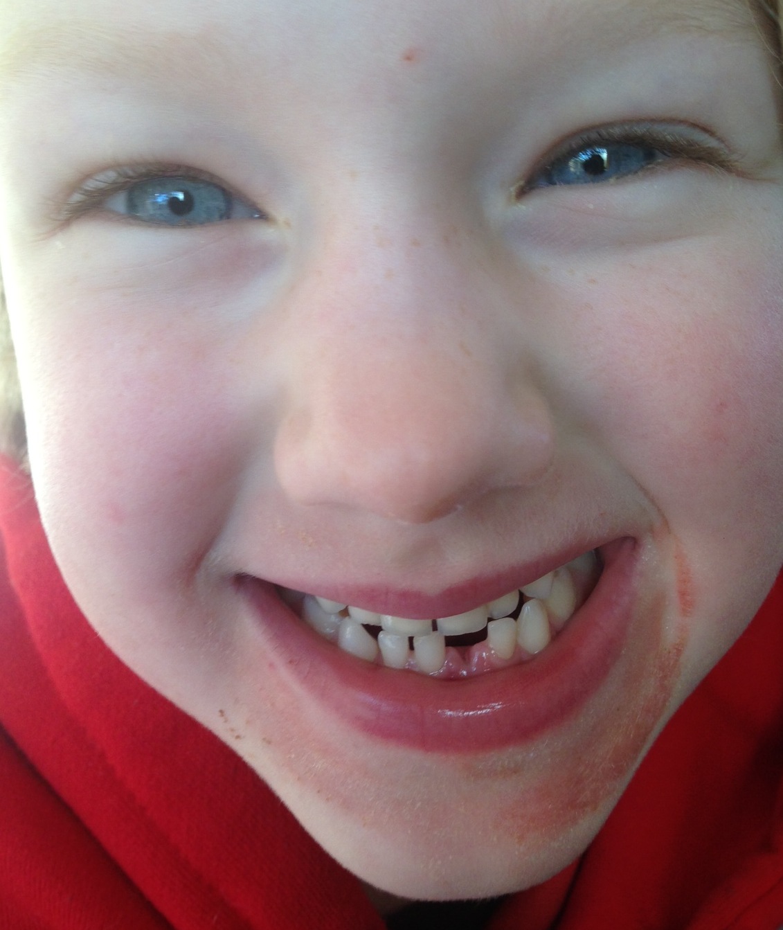 Amazing Adventures: The first lost tooth