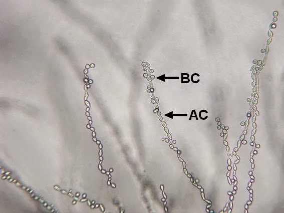 Fun With Microbiology (What's Buggin' You?): Trichosporon species