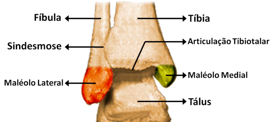 FRATURA DO TORNOZELO (MALÉOLO LATERAL): FRATURA DO TORNOZELO (MALÉOLO ...