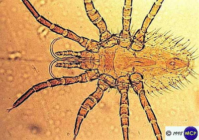 Variety of Life: Macronyssidae